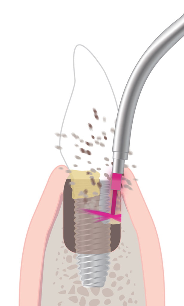 Implantology News - New Morita Products to Debut at the Academy of ...