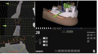 X-Guide® Dynamic 3D Navigation system Implant Practice US - Dental ...