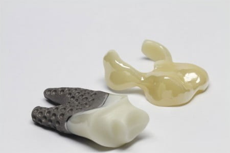Implantology News - REPLICATE™ Immediate Tooth Replacement System to be ...