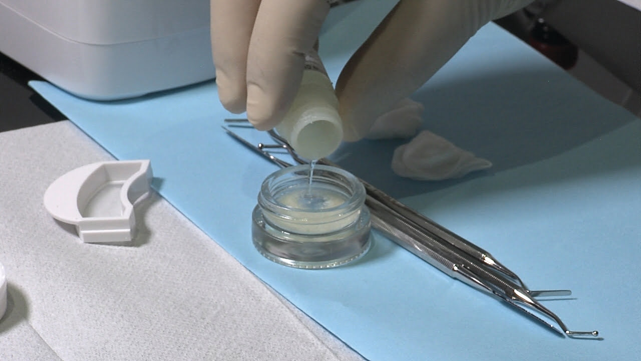 Implant CE Article - Autologous bone grafting using extracted teeth Implant CE Article - Autologous bone grafting using extracted teeth