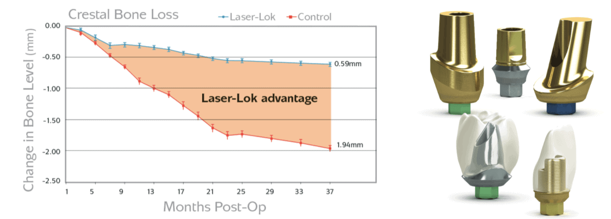 Long-term case studies using a Laser-Lok® implant Implant Practice US ...