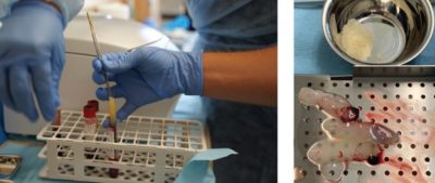 Eliminating the problem of incision-line opening