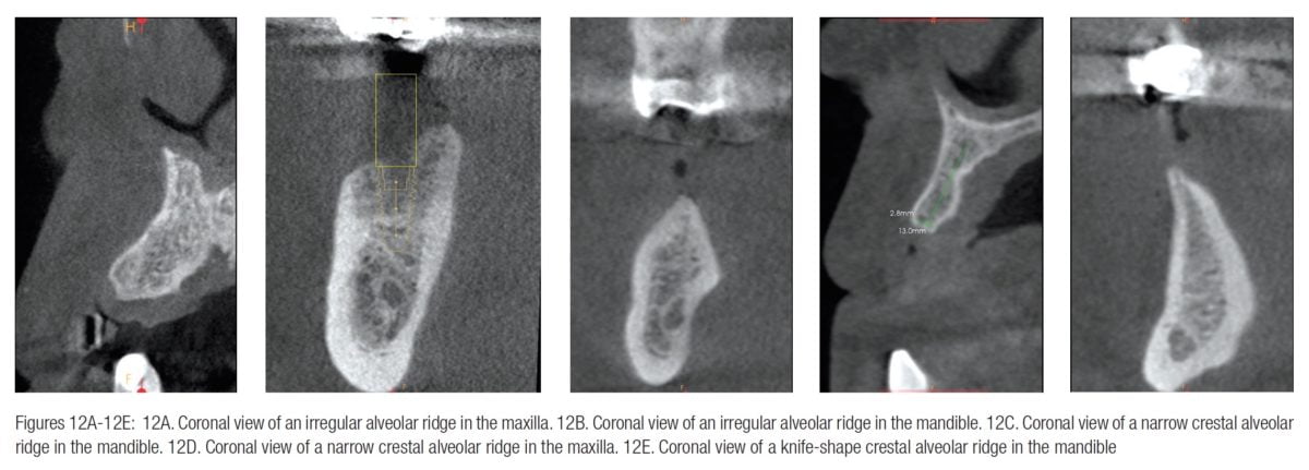 Essential guidelines for using CBCT in implant dentistry — clinical ...