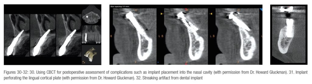 Implant CE Article - Essential guidelines for using CBCT in implant ...