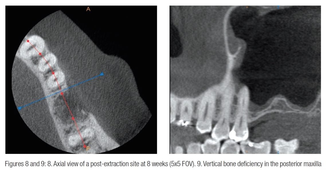 Essential guidelines for using CBCT in implant dentistry — clinical ...