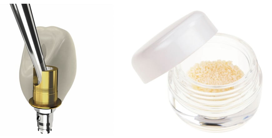 Zimmer Biomet introduces the SmileZ Today™ Box