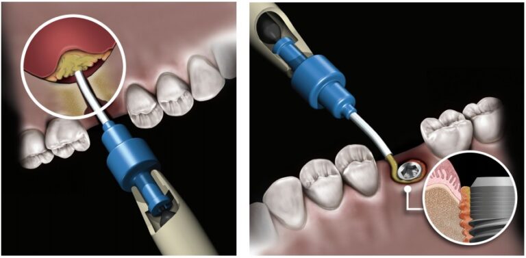 NovaBone® Products — experts in bone formation