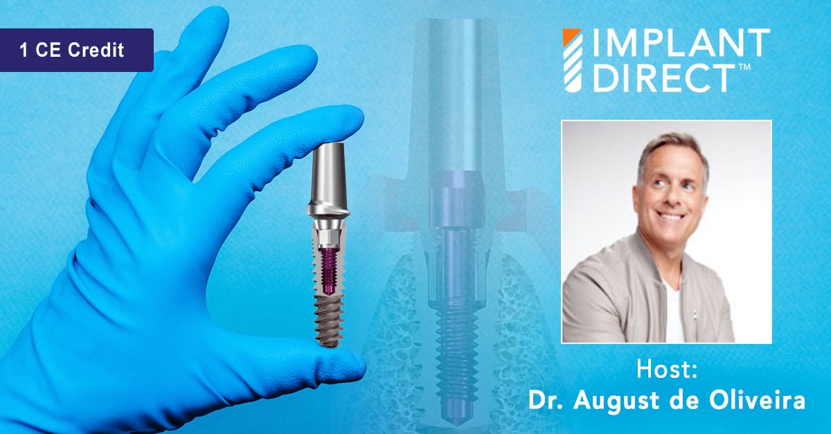 Evolution of Implant Connections