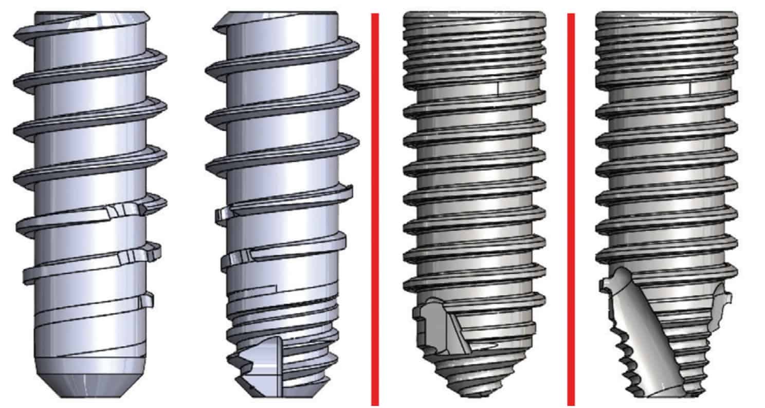 Improved implant stability — achievable with Unifi MI implant