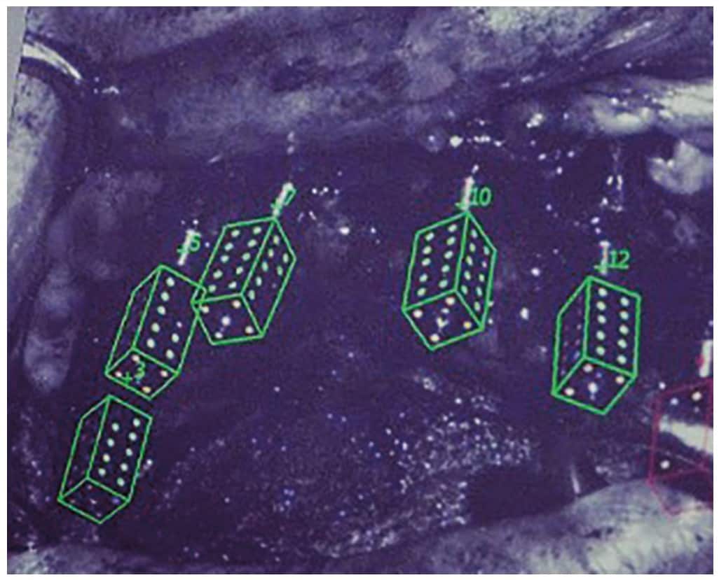 Photogrammetry — advancement in digital technology for implants