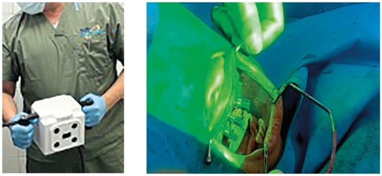 Photogrammetry — advancement in digital technology for implants
