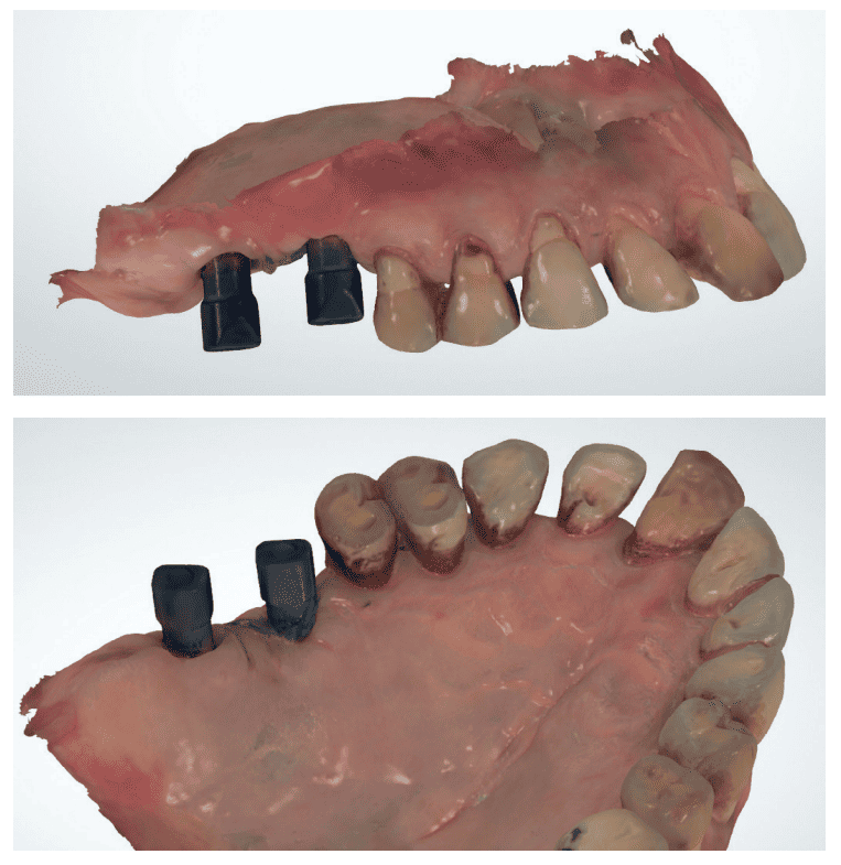 Preat — providing solutions for restorative consistency