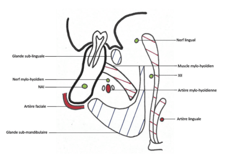 The CAD/CAM SUB Implant™ by Panthera Dental — managing atrophic ...