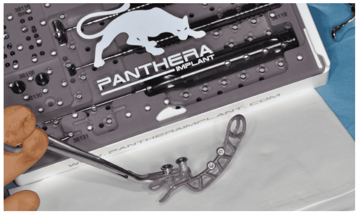 The CAD/CAM SUB Implant™ by Panthera Dental — managing atrophic ...