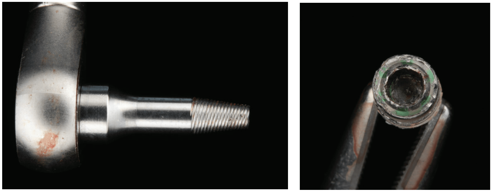 Implant removal: why and how