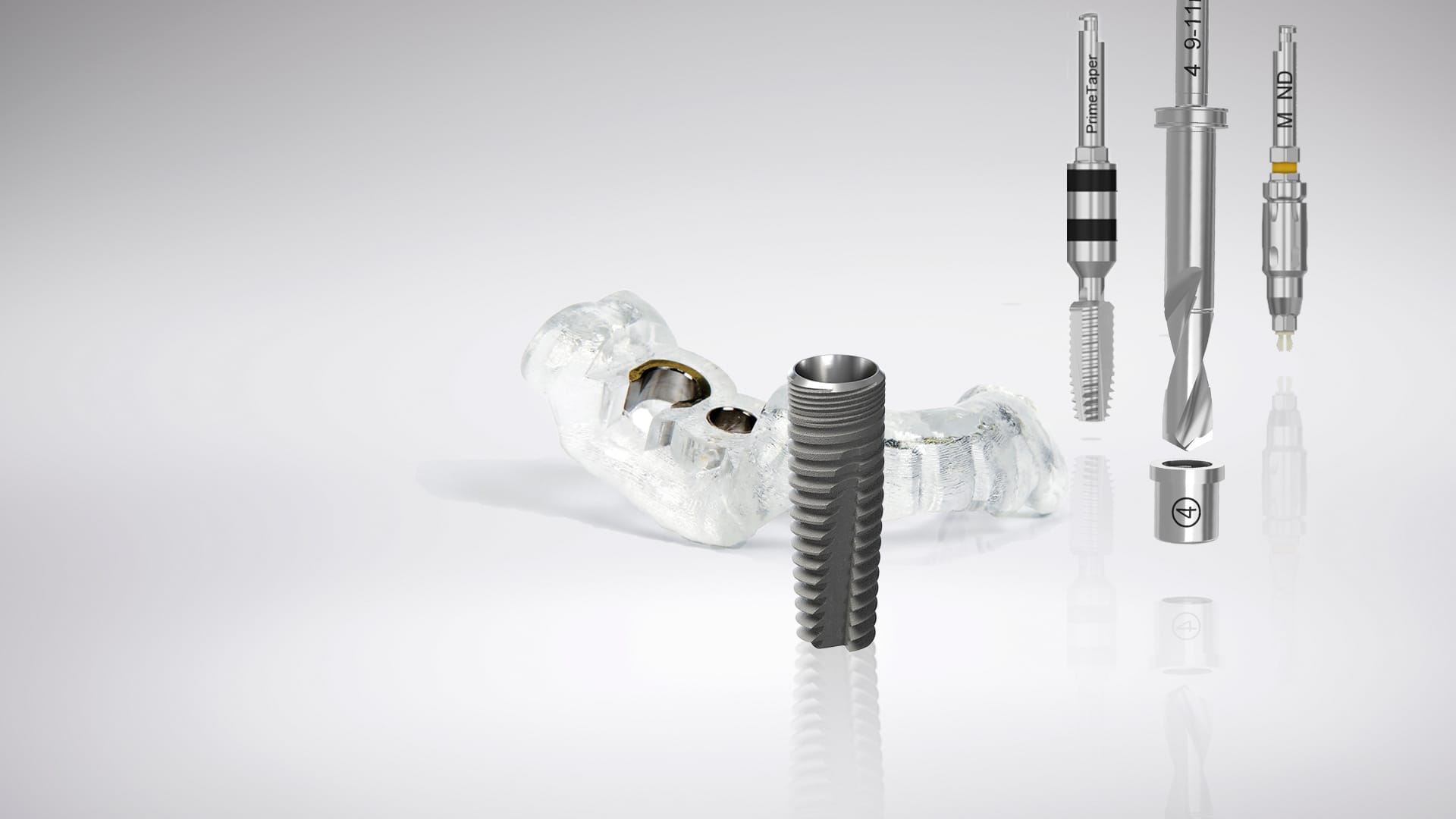 Implantology News - Dentsply Sirona's PrimeTaper EV Implant Achieves ...