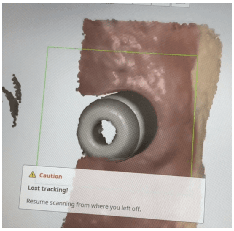 Intraoral scanning — key to full-arch implant positioning